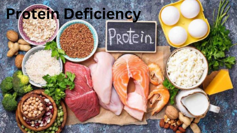 "Protein Deficiency Causes These Serious Symptoms, High-Protein Foods ...